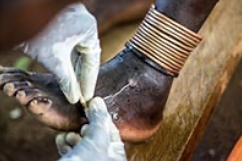 Carter Center Applauds Historic World Health Assembly Resolution to ...