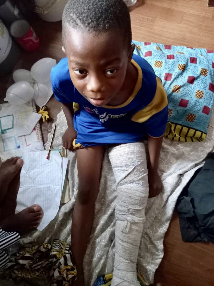 Elijah 10, His Broken Leg, And A Story You Can Give A Happy Ending