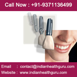 Tooth Implantation in India to Fix Missing Teeth Disorders