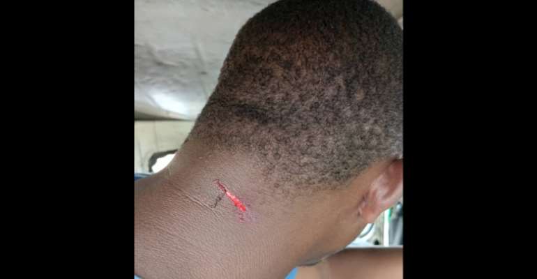 Zambian Journalist Attacked, Facing Criminal Charges After Covering ...